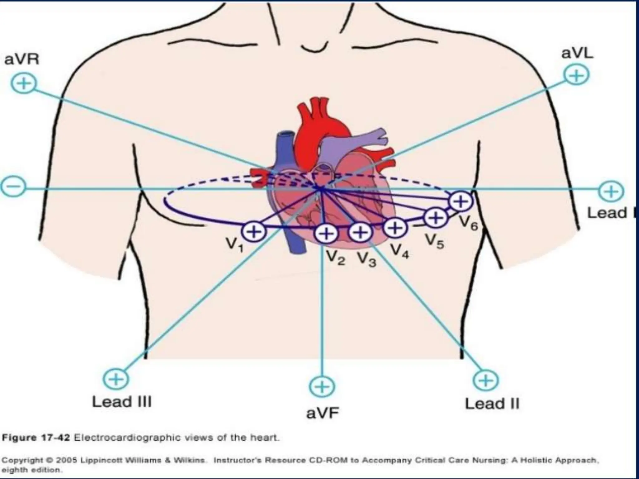 Skill ECG (1) Ischemia for students .pptx