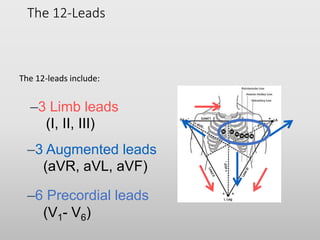 Skill ECG (1) Ischemia for students .pptx
