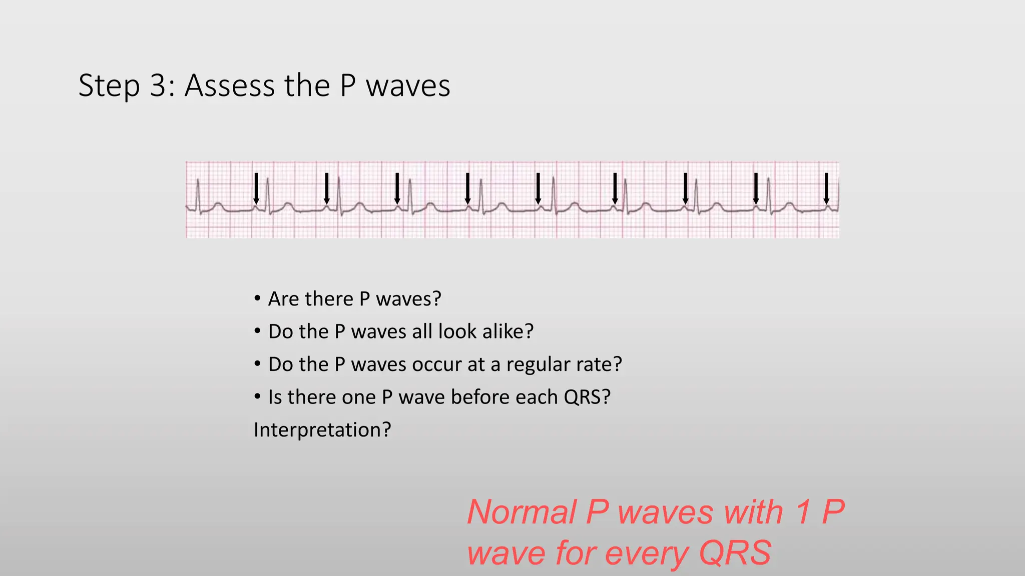 Skill ECG (2) arrhythmia for students.pptx