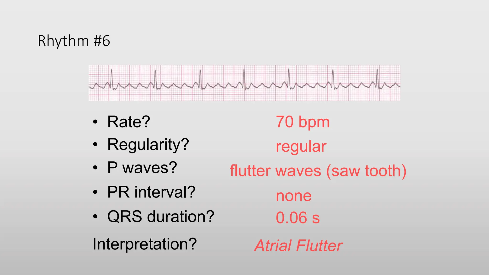 Skill ECG (2) arrhythmia for students.pptx