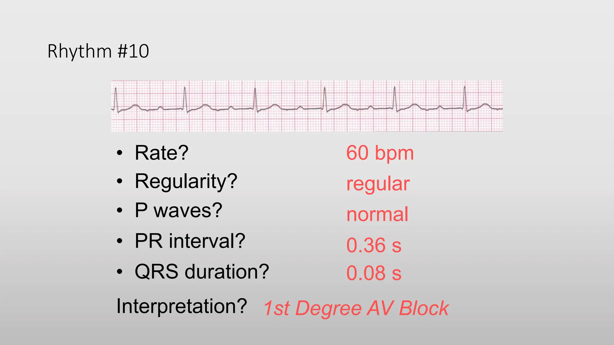 Skill ECG (2) arrhythmia for students.pptx