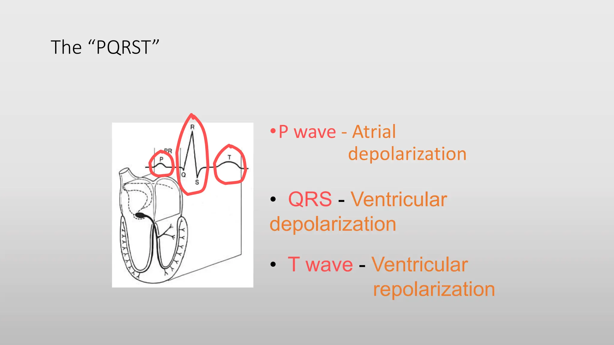 Skill ECG (2) arrhythmia for students.pptx