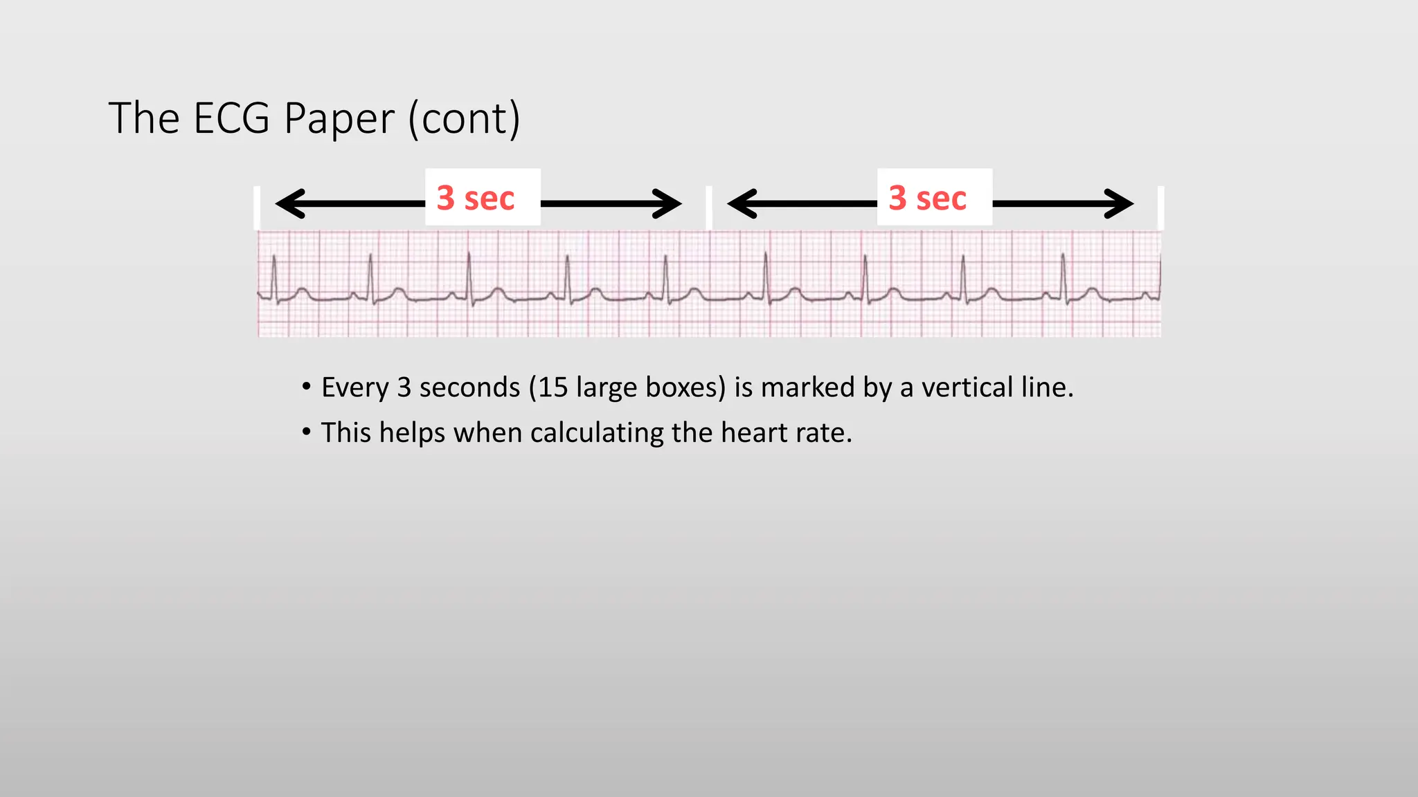 Skill ECG (2) arrhythmia for students.pptx
