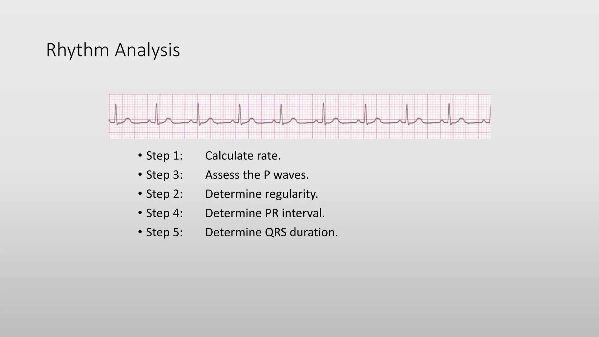 Skill ECG (2) arrhythmia for students.pptx