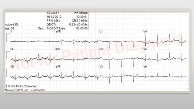 Skill ECG (2) arrhythmia for students.pptx