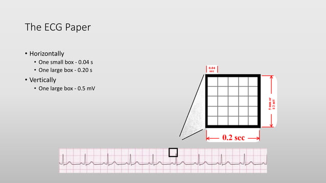 Skill ECG (2) arrhythmia for students.pptx