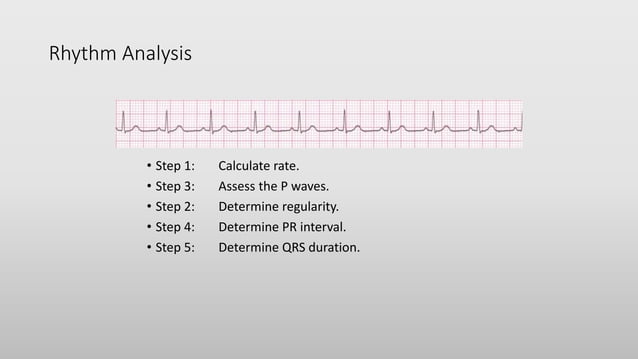 Skill ECG (2) arrhythmia for students.pptx