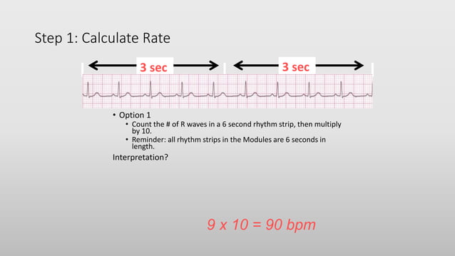 Skill ECG (2) arrhythmia for students.pptx