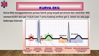 MATERI SKILL EKG DALAM PELATIHAN BTCLS .ppt