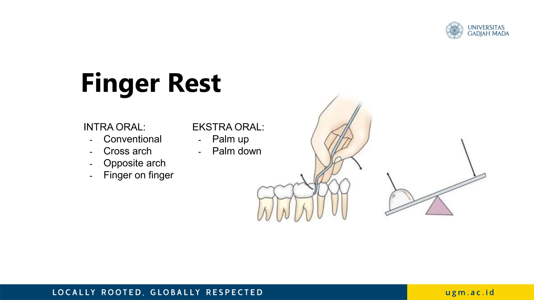 Skill lab scaling manual dan ultra sonic scaler | PPTX