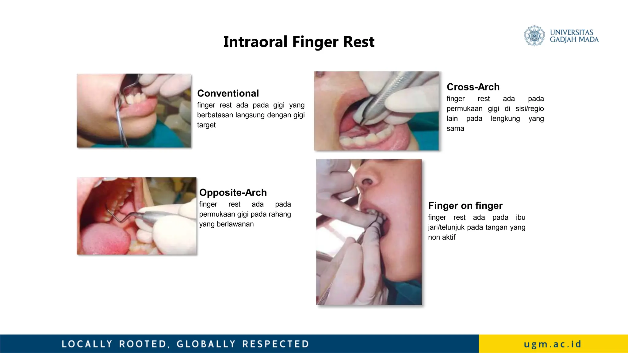 Skill lab scaling manual dan ultra sonic scaler | PPTX