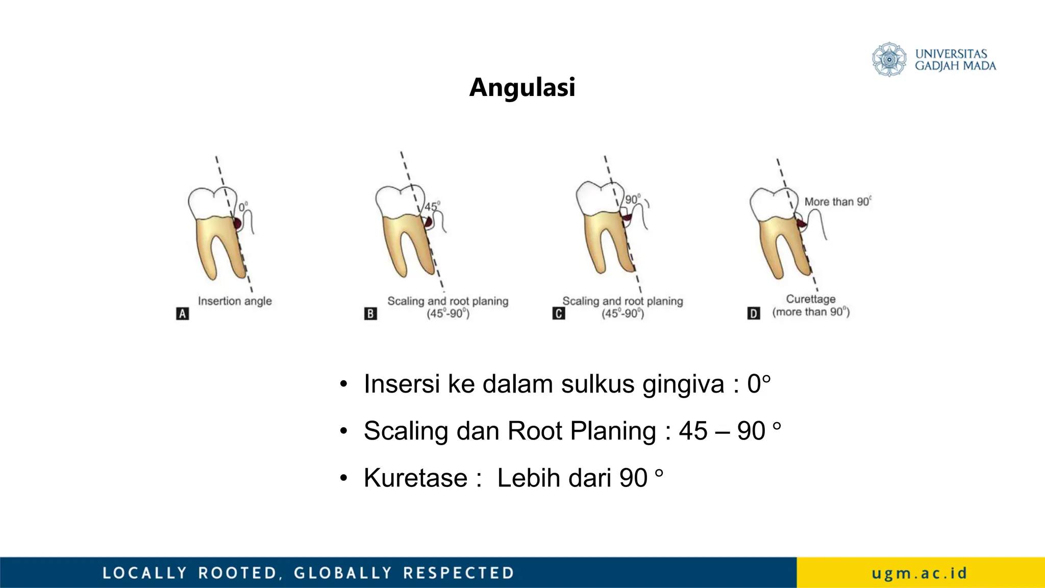 Skill lab scaling manual dan ultra sonic scaler | PPTX