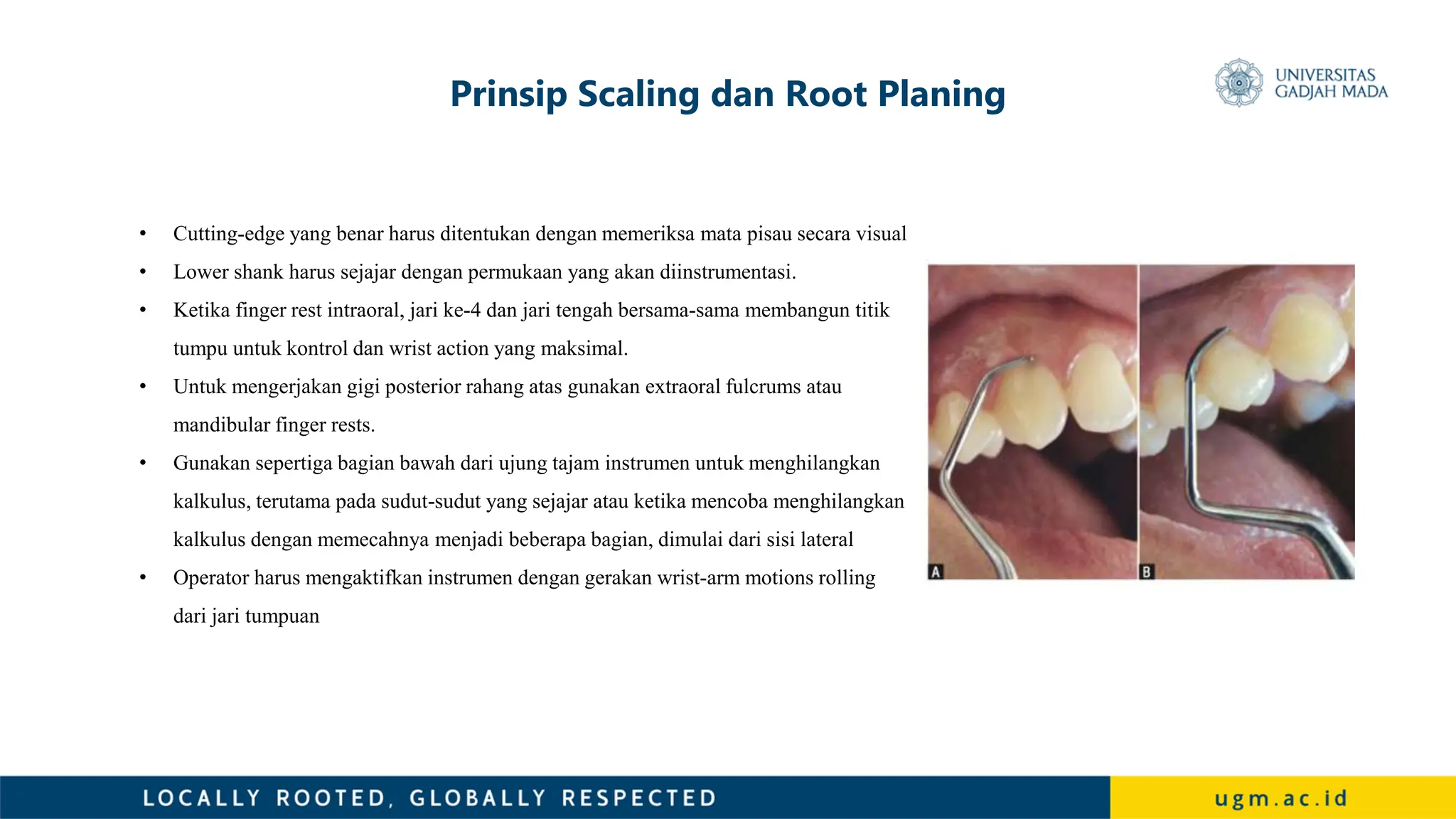 Skill lab scaling manual dan ultra sonic scaler | PPTX