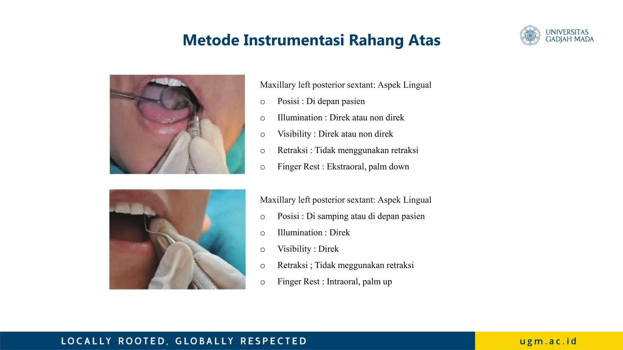 Skill lab scaling manual dan ultra sonic scaler | PPTX
