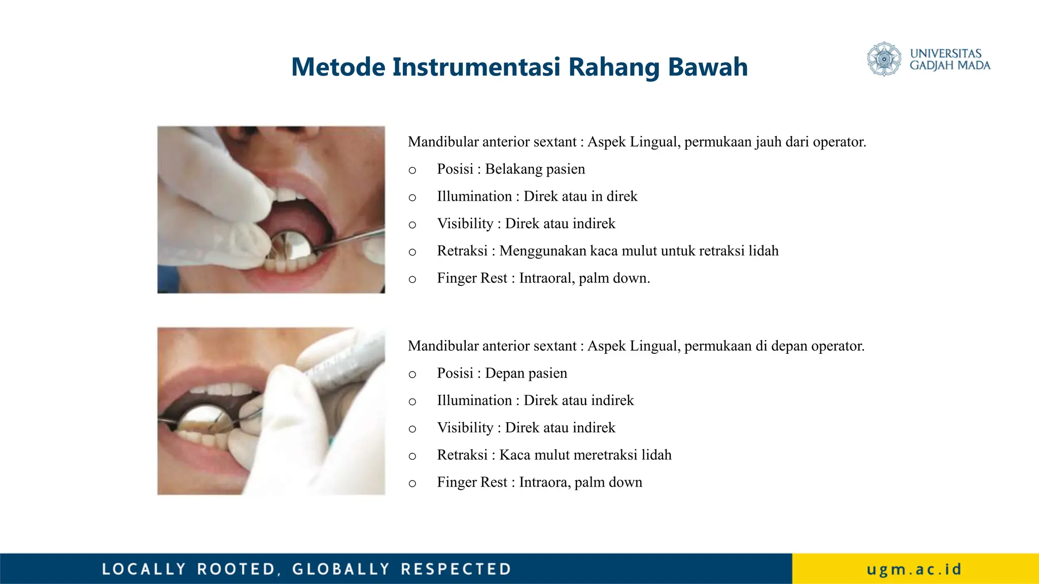 Skill lab scaling manual dan ultra sonic scaler | PPTX