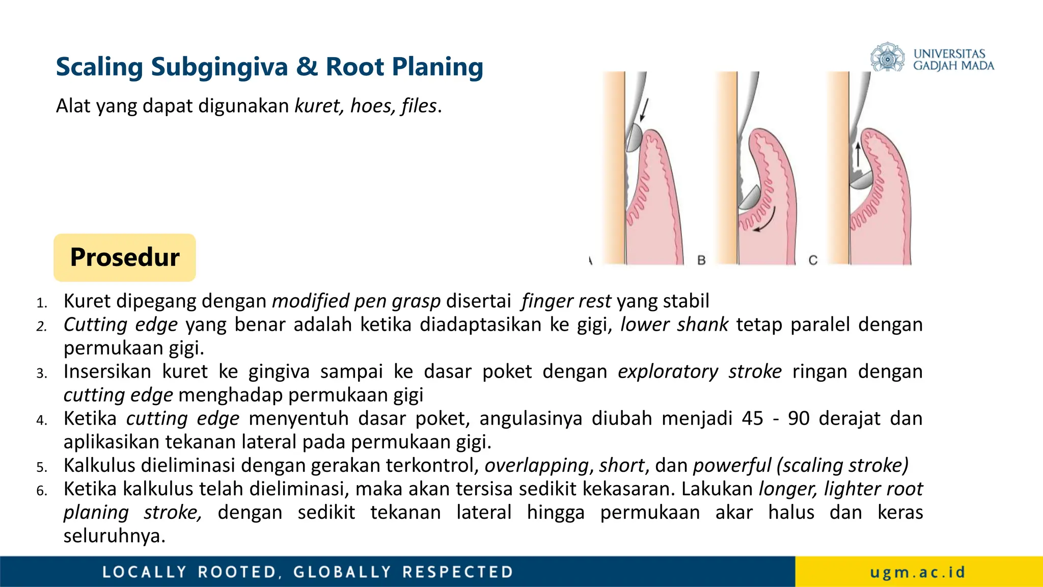 Skill lab scaling manual dan ultra sonic scaler | PPTX