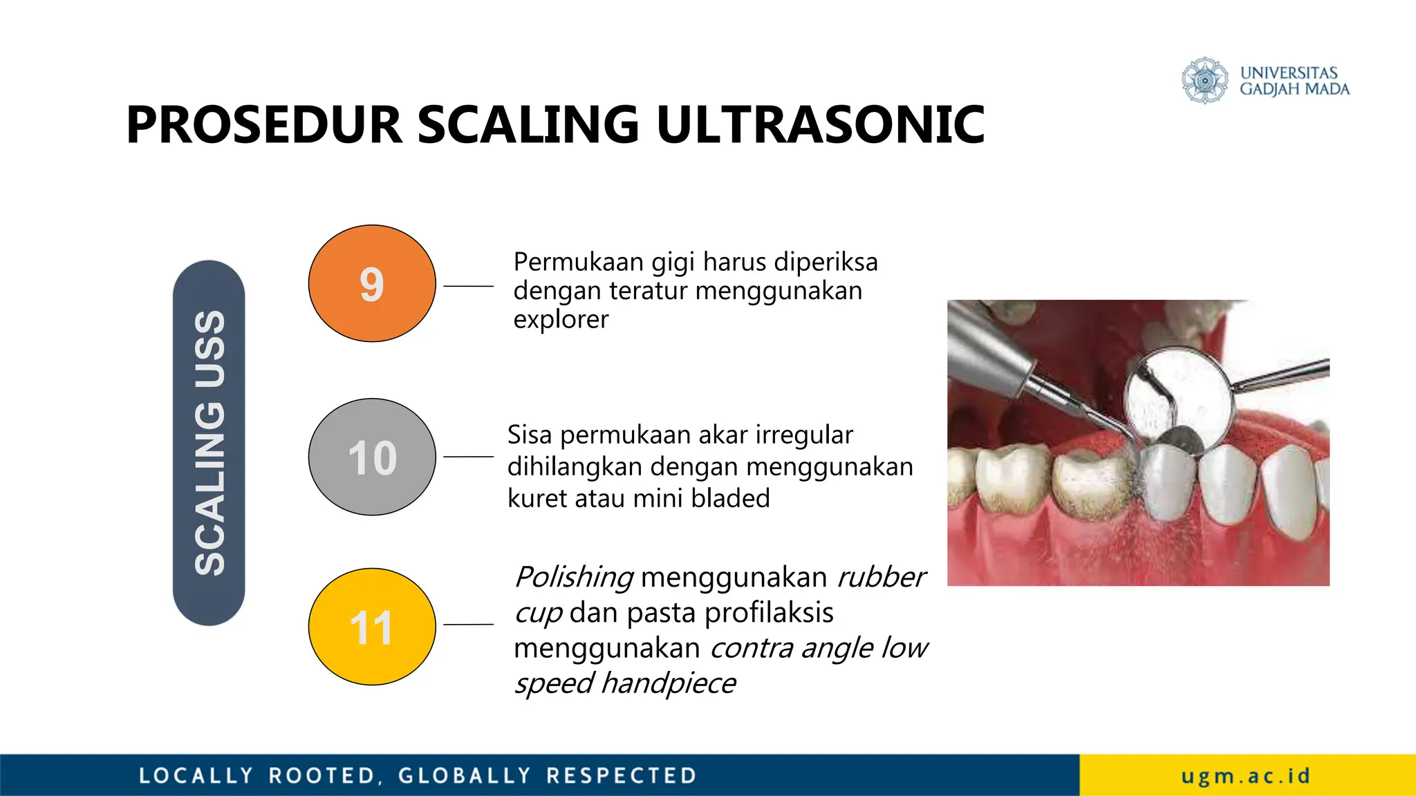 Skill lab scaling manual dan ultra sonic scaler | PPTX