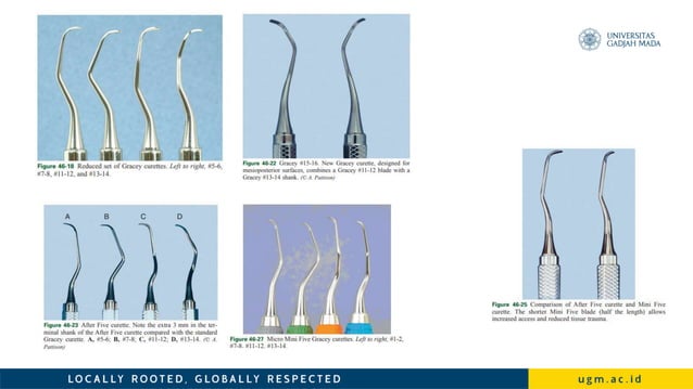 Skill lab scaling manual dan ultra sonic scaler | PPTX