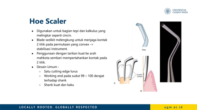 Skill lab scaling manual dan ultra sonic scaler | PPTX