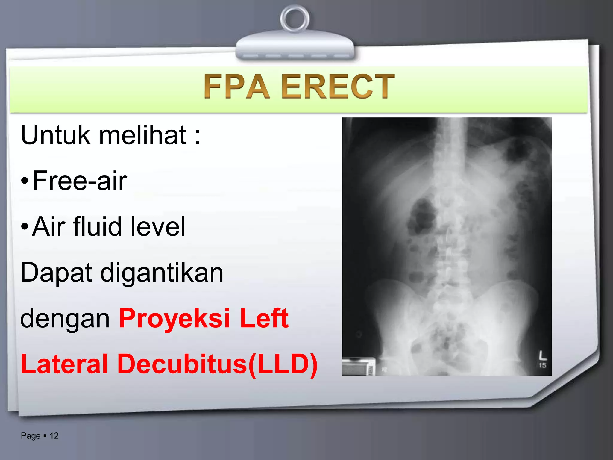SKILL RADIOLOGI FOTO POLOS ABDOMEN.pdf