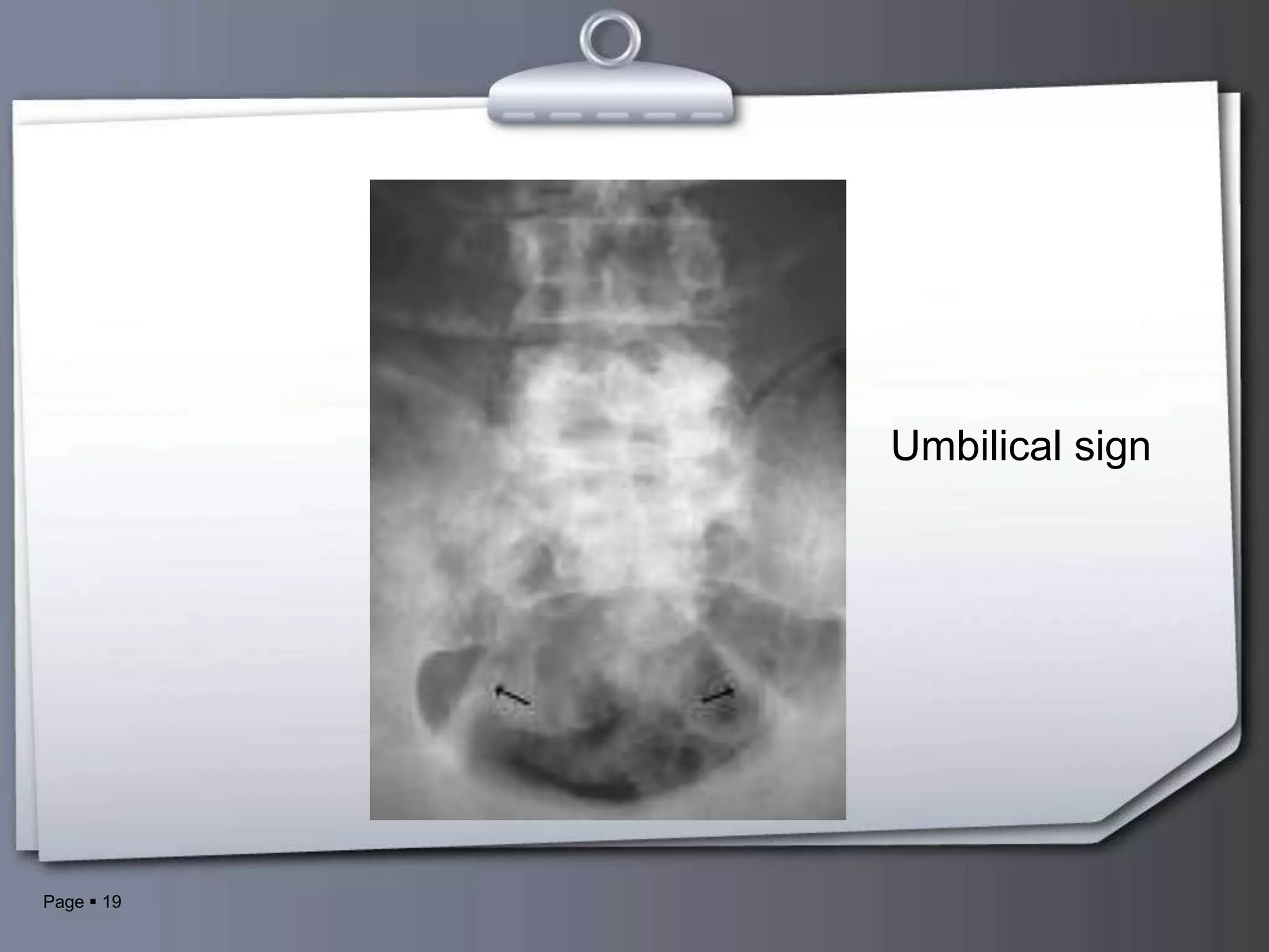 SKILL RADIOLOGI FOTO POLOS ABDOMEN.pdf