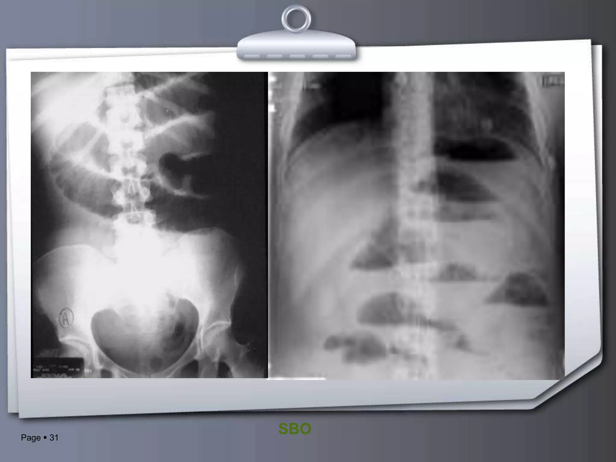 SKILL RADIOLOGI FOTO POLOS ABDOMEN.pdf
