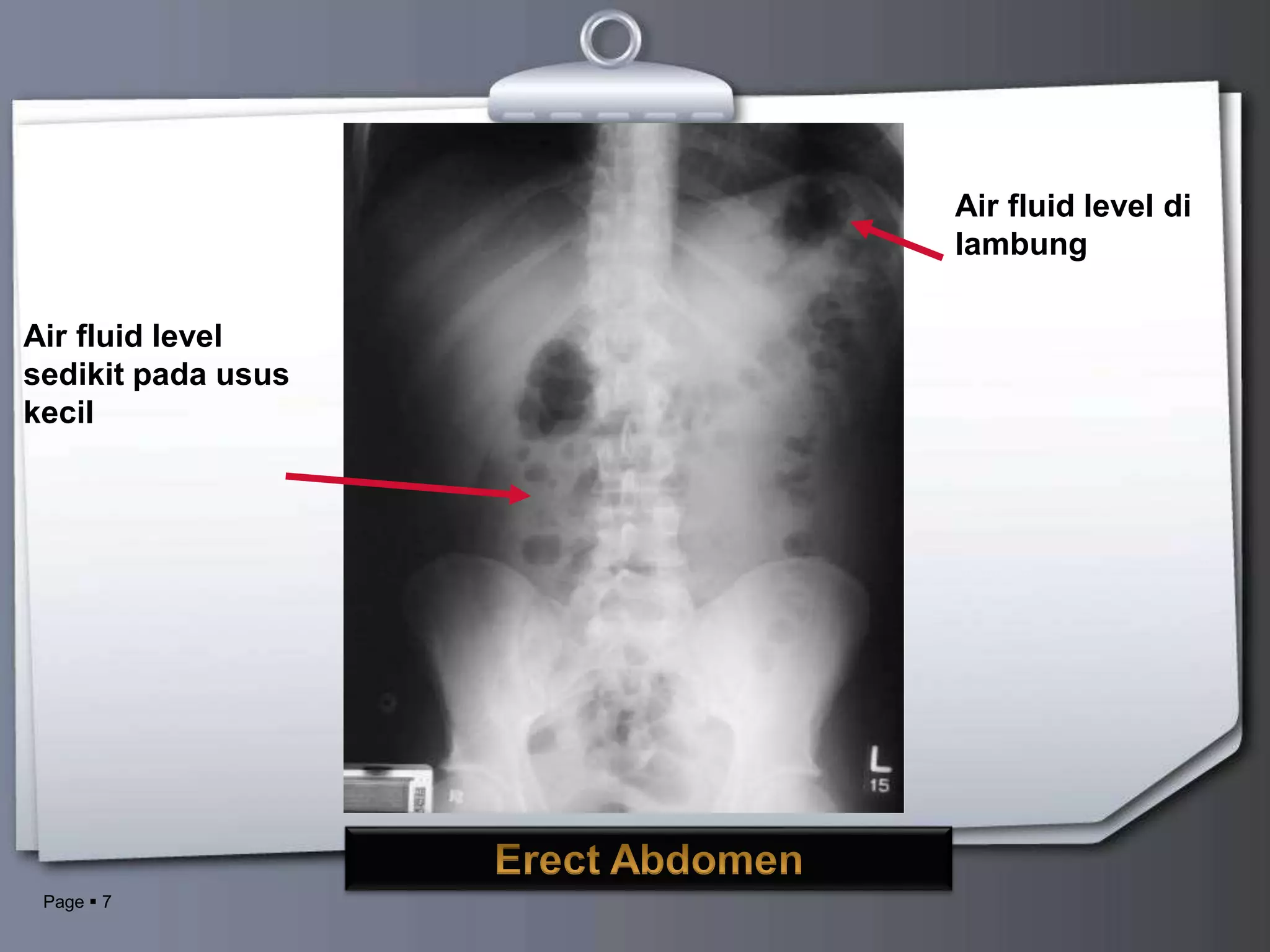 SKILL RADIOLOGI FOTO POLOS ABDOMEN.pdf