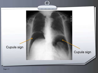 SKILL RADIOLOGI FOTO POLOS ABDOMEN.pdf