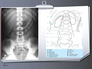 SKILL RADIOLOGI FOTO POLOS ABDOMEN.pdf