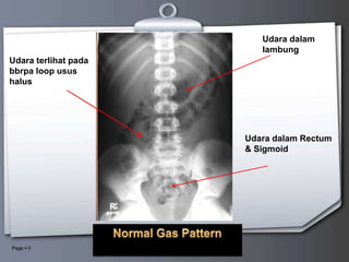 SKILL RADIOLOGI FOTO POLOS ABDOMEN.pdf