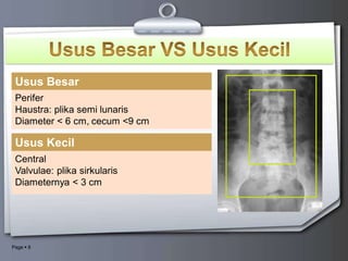 SKILL RADIOLOGI FOTO POLOS ABDOMEN.pdf