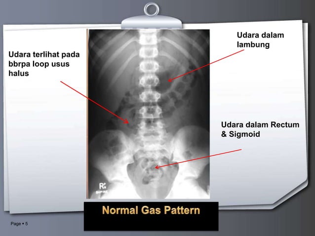SKILL RADIOLOGI FOTO POLOS ABDOMEN.pdf