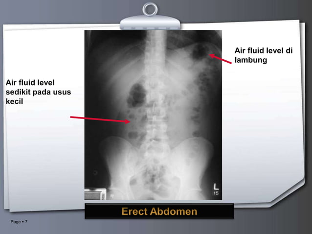 SKILL RADIOLOGI FOTO POLOS ABDOMEN.pdf