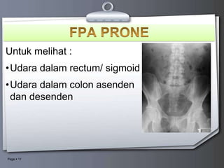 SKILL RADIOLOGI FOTO POLOS ABDOMEN.pdf