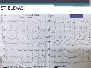 SKILL SITE EKG basi. Trauma cardiac uis.pptx