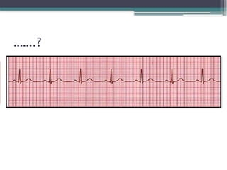 SKILL SITE EKG basi. Trauma cardiac uis.pptx