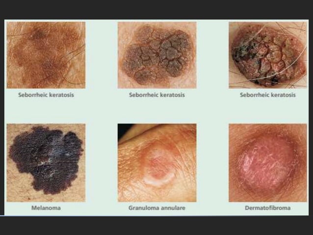 Status Dermatologikus