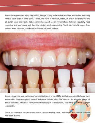 Skimming Over Dental Imperfections | PDF