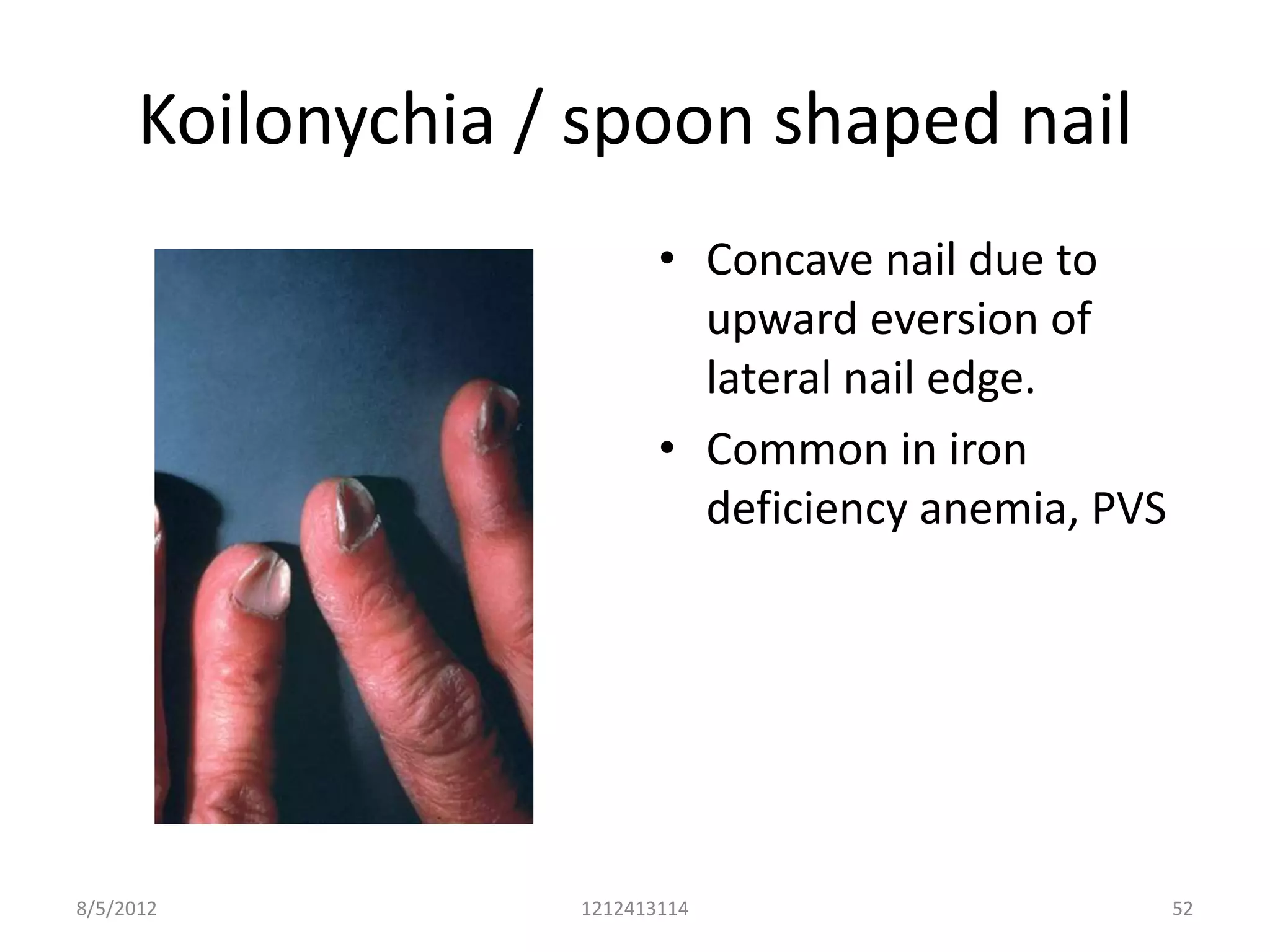 Skin and its appendages | PPTX