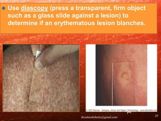 Skin Examination | PPTX