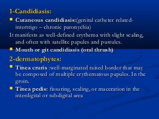 common Skin infections | PPT | Infectious Diseases | Diseases and ...