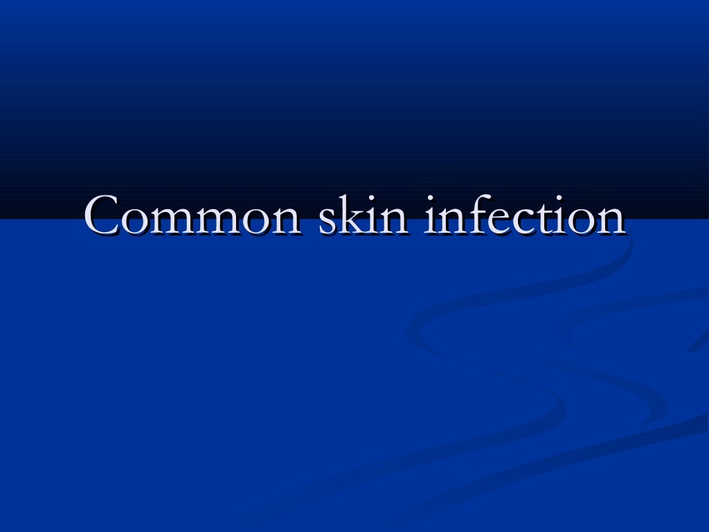 common Skin infections | PPT | Infectious Diseases | Diseases and ...