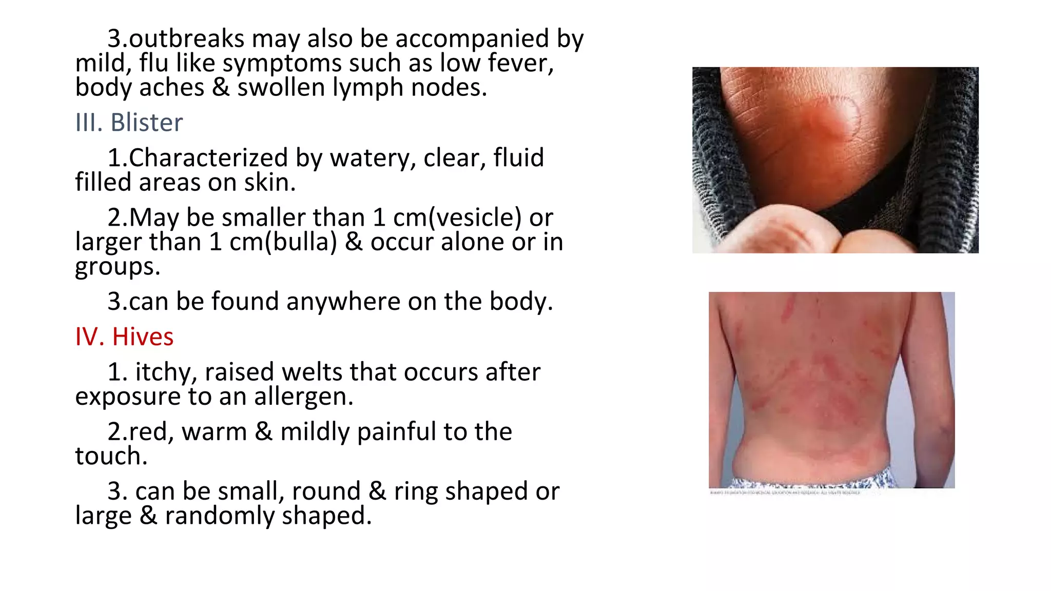 Skin structure function and disease | PPT