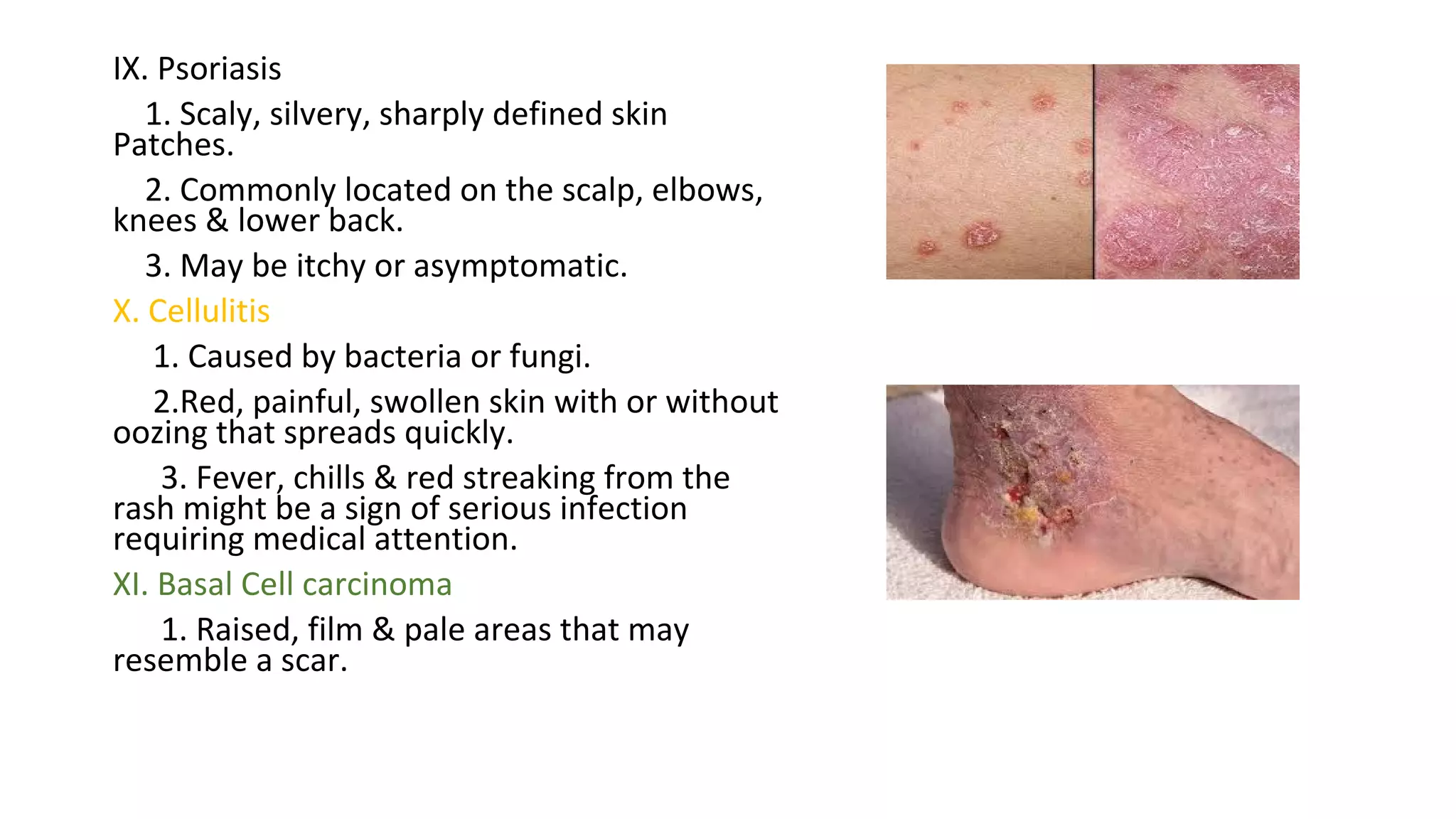Skin structure function and disease | PPT
