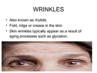 Skin | PPT