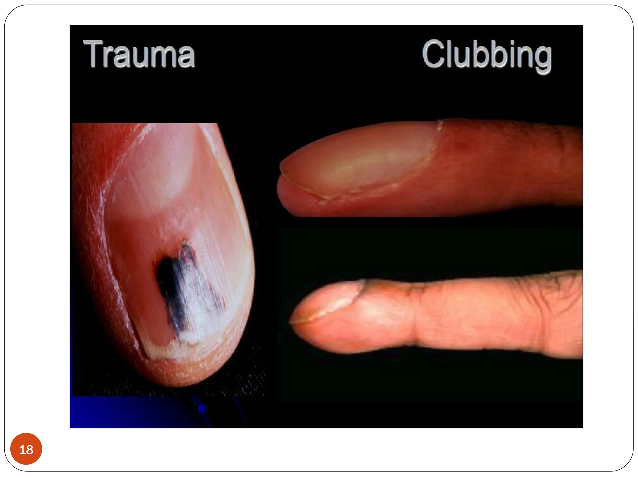 skin.pptThe integumentary system consists of the skin, hair, nails ...