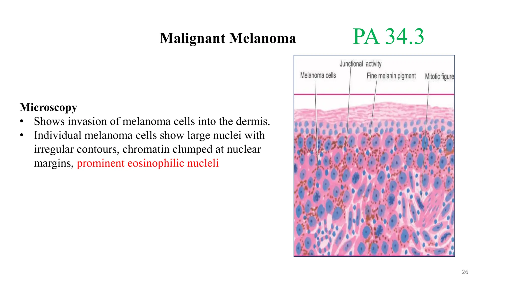 Skin ( basal cell carcinoma, malignant melanoma etc.) | PDF