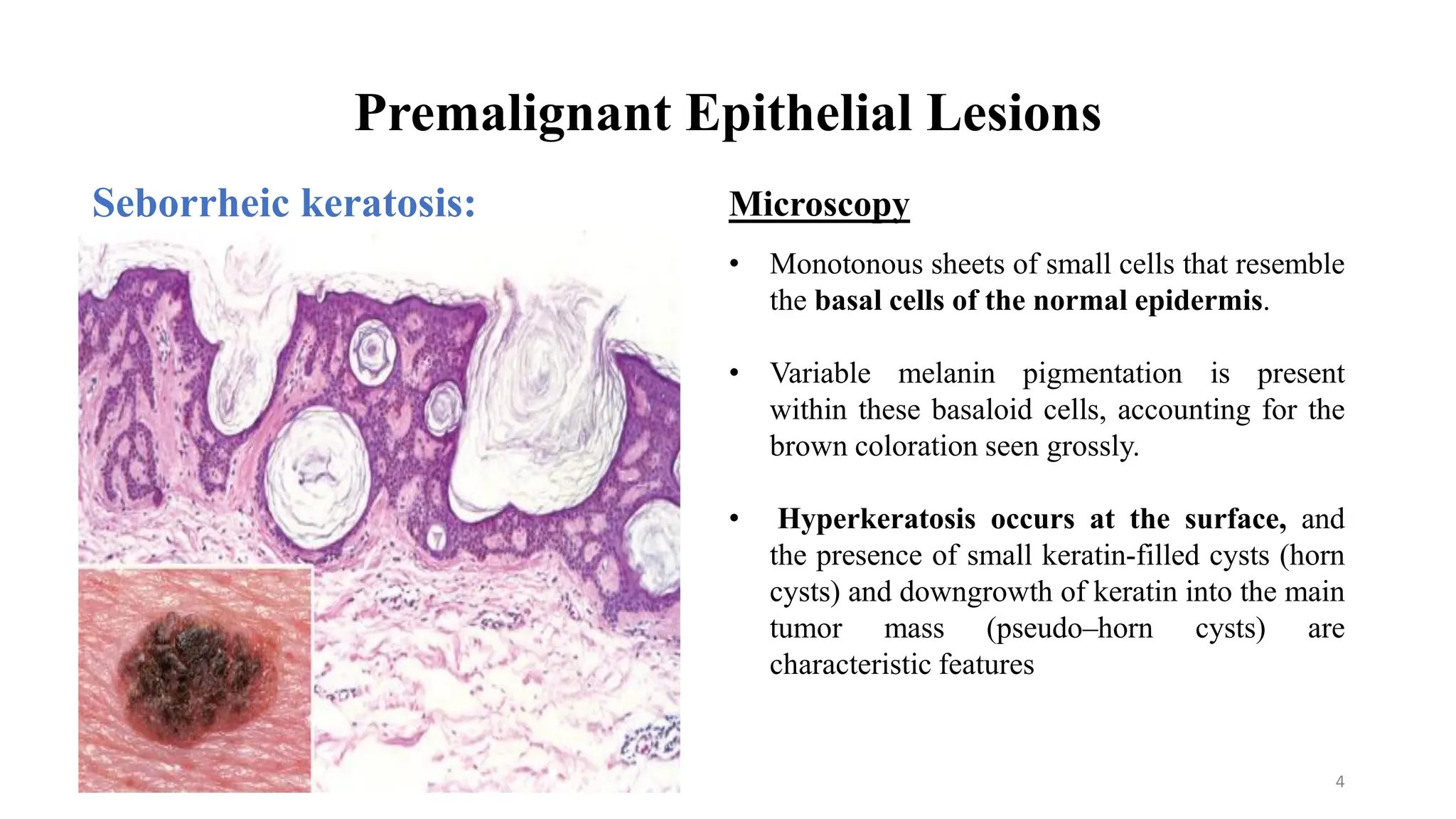 Skin ( basal cell carcinoma, malignant melanoma etc.) | PDF