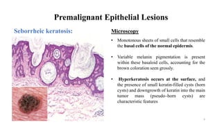 Skin ( basal cell carcinoma, malignant melanoma etc.) | PDF