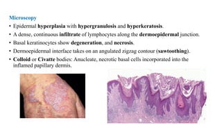 Skin ( basal cell carcinoma, malignant melanoma etc.) | PDF